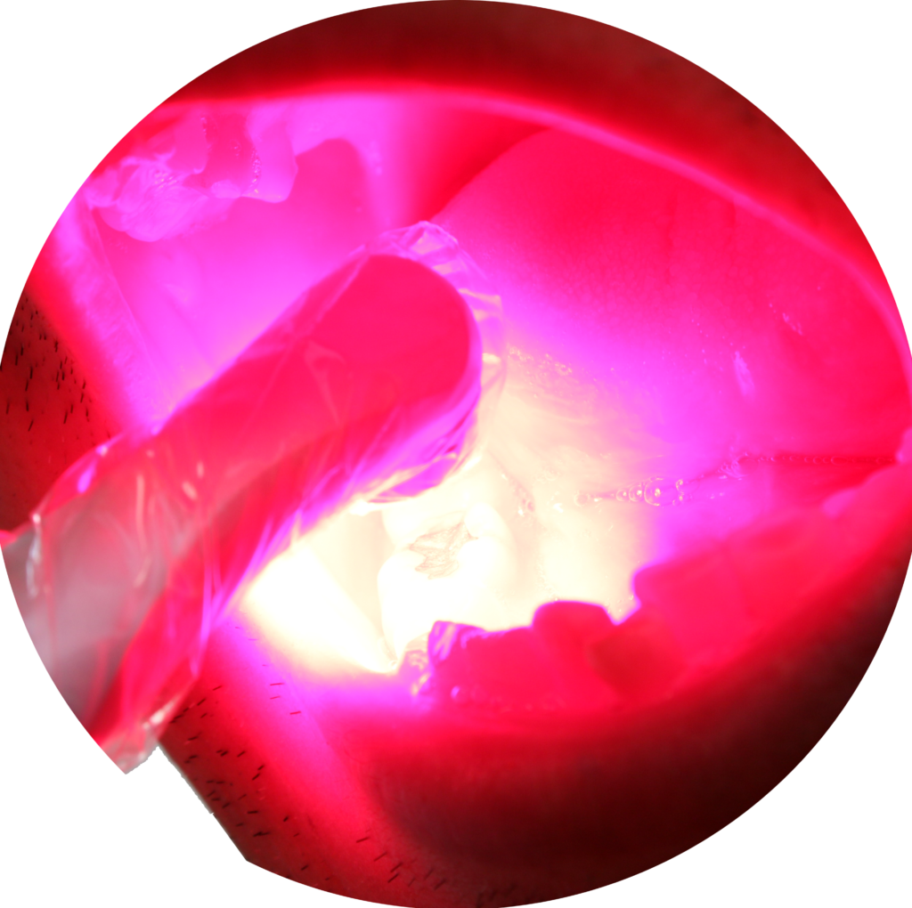 Photobiomodulation - Dentlight